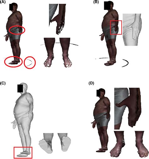 Automatic Post‐processing For The Raw 3d Scanning Data In The Wear