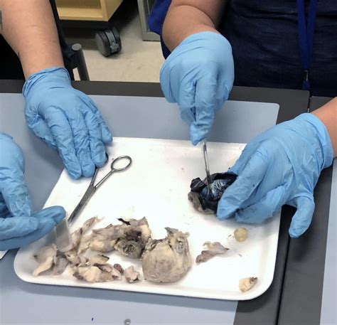 Cow Eye Dissection Perkins School For The Blind