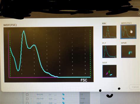 How To Interpret Sysmex Wdf Fsc R Medlabprofessionals