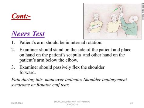 Shoulder Joint Introduction Examination Frozen Shoulder
