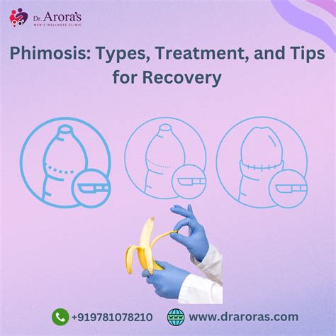 Phimosis Understanding Tight Foreskin And Its Management Umrdtq