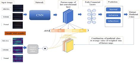 Figure 1 From A Convolutional Neural Network Based Explainable Classification Method Of Spect