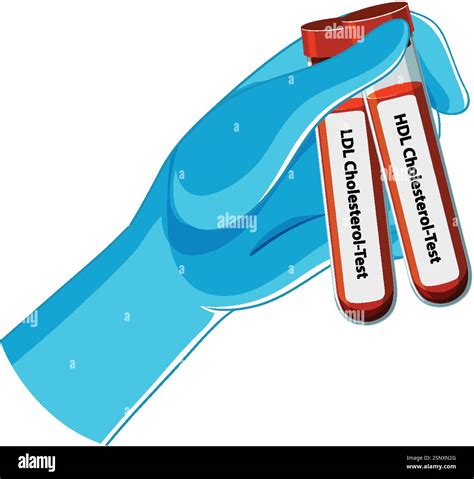 Hand Holding Ldl And Hdl Test Tubes Stock Vector Image And Art Alamy