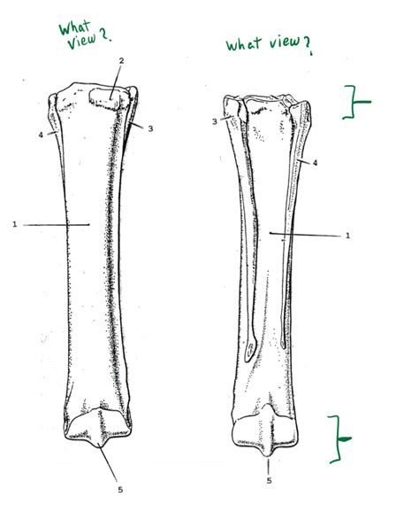 Metacarpal Bones Diagram Diagram Quizlet