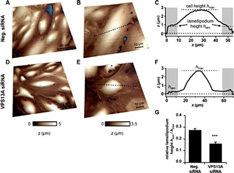 sicm high resolution topography imaging of huvecs with or without