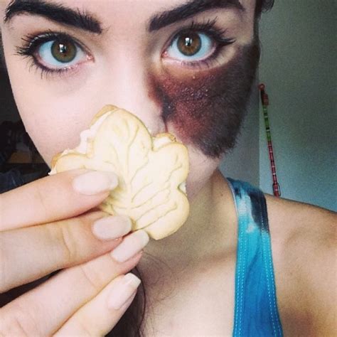 People Told Her To Remove Her Birthmark But She Chose To Embrace It