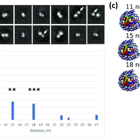Heterogeneity In The Structure Of Codis Analysis By Electron