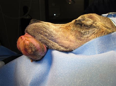 Maxillectomy Radical — Dr Julius M Liptak