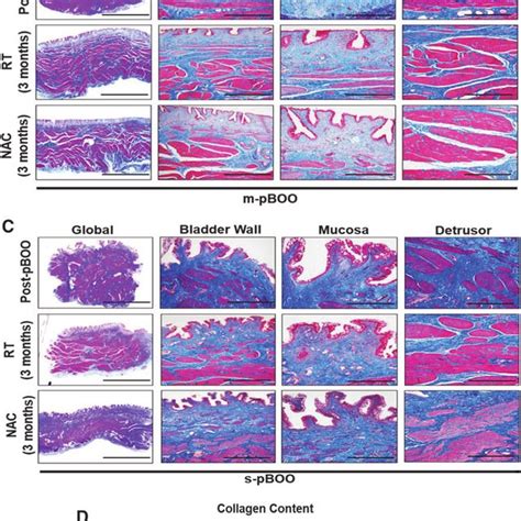 Porcine Pboo And Augmentation Cystoplasty Models A Creation Of Pboo