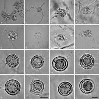 Pythium Oopapillum A Filamentous Inflated Sporangium Constrictions Download Scientific
