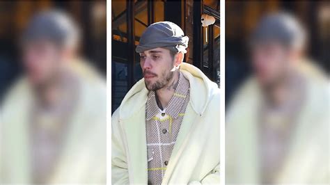 Justin Bieber völlig blass erschöpft und abgemagert Fans machen sich