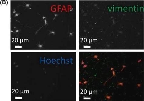 Vimentin Sigma Aldrich