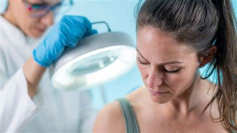 Fast Five Quiz Atopic Dermatitis Differential Diagnosis Frank Herd