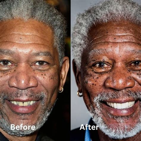 Celebrity Teeth 60 Photos Moonagedaydream Film