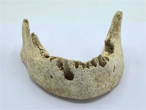 Antique Medical Geriatric Lower Jaw Bone