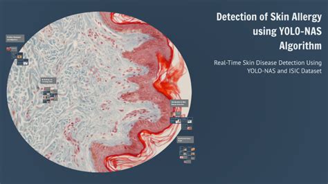 Detection Of Skin Allergy Using Yolo Nas Algorithm By 057 Srimathi K On