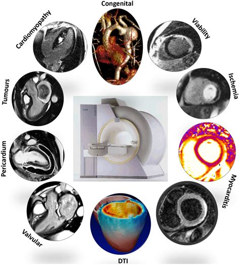 Cardiovascular Magnetic Resonance Past Present And Future