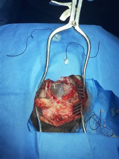 Dr Supreeth C S Posted On Linkedin