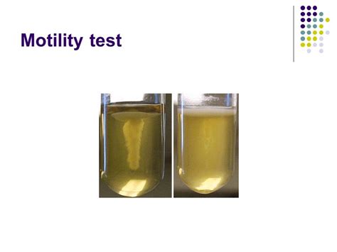 Unknown Bacterial Identification Ppt Video Online Download