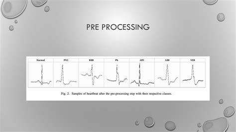 Ppt Heartbeat Anomaly Detection Using Adversarial Oversampling Powerpoint Presentation Id