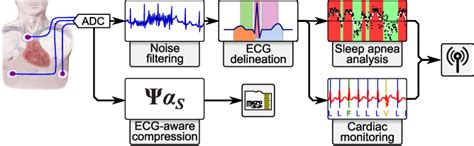 Figure From Online Obstructive Sleep Apnea Detection On Medical Wearable Sensors Semantic