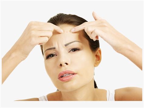 You Have A Giant Fucking Zit Skinosm Pimple Popper Tool Curved Tweezers Metal Blackhead Free