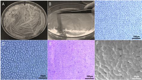 Fresh Amniotic Membrane Macroscopic And Microscopic Observation A Download Scientific
