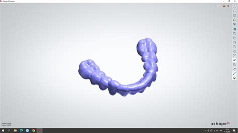 Stl File Splint Design Ready For Print・3d Printable Model To Download・cults