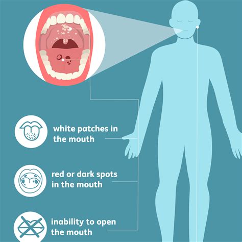 Leukoplakia Symptoms Causes Diagnosis And Treatment