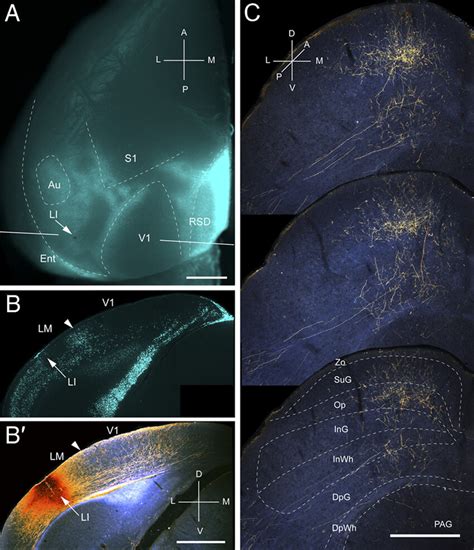 Projections Of Li To The Sc A In Situ Image Of Callosal Connections Download Scientific