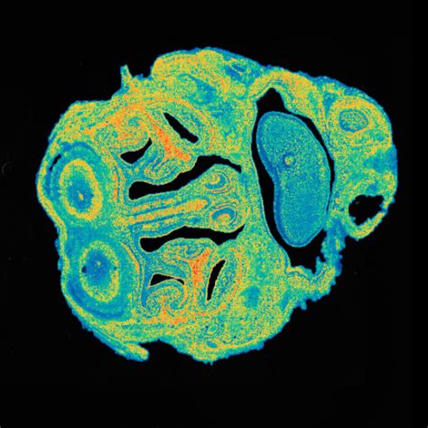 Stereo Seq Spatial Transcriptomics — Admera Health