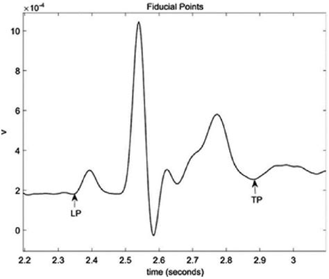 ecg heartbeat segmentation download scientific diagram