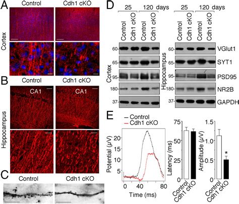 Apc Ccdh1 Rock2 Pathway Controls Dendritic Integrity And Memory Pnas