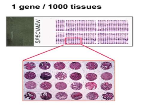 Tissue Microarray