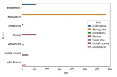 Automated Non Invasive Skin Cancer Detection Using Dermoscopic Images