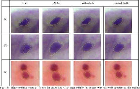 Figure 13 From Combining Shape Texture And Intensity Features For Cell Nuclei Extraction In Pap