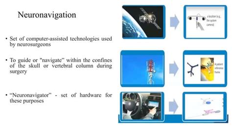 Application Of Neuronavigation In Brain Surgery Pptx