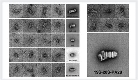 Electron Micrographs Of A Negatively Stained Proteasome Mixture Showing