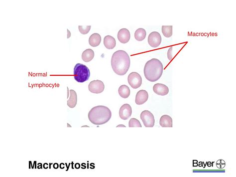 Ppt Advia 120 Case Studies Powerpoint Presentation Free Download