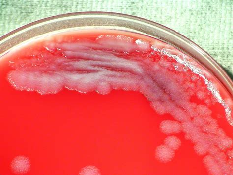 Gambar Gratis Gambar Bacillus Anthracis Bakteri Koloni