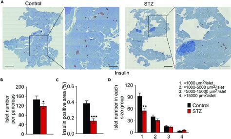 Insulin Immunostaining In Pancreas Of Streptozotocin Stz Induced
