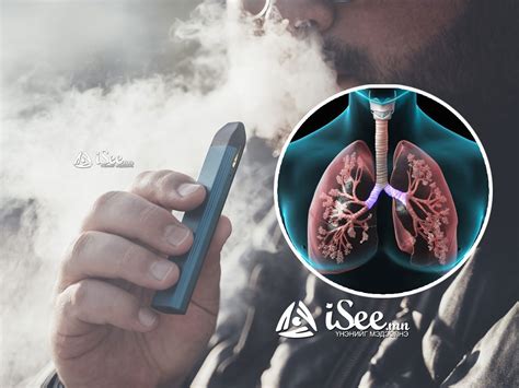 СУДАЛГАА Электрон тамхи энгийн тамхины адил УУШГИЙГ ГЭМТЭЭЖ ДОНТУУЛДАГ Isee Mn