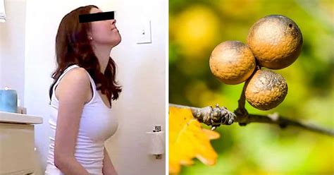 Doctors Warn Women Against Putting Wasp Nests Inside Their Privates In New Bizarre Trend Elite