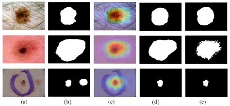 Diagnostics Free Full Text A Collaborative Learning Model For Skin Lesion Segmentation And