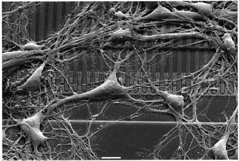 Scanning Electron Micrograph Showing Neurons From Rat Hippocampus