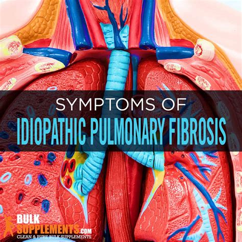 Fibrose Pulmonar Idiopatica Idiopathic Pulmonary Fibrosis Pathogenesis