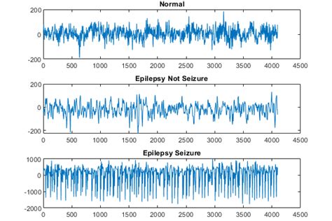Eeg Signals Normal Epilepsy Not Seizure Epilepsy Download Scientific Diagram