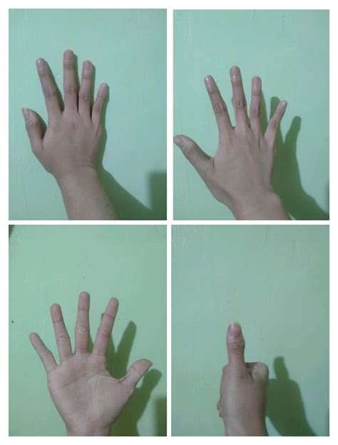 Why My Fingers Hands Looks Like This 😭😭 Im Only 15 And Girl And I