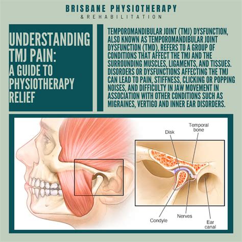 Understanding Tmj Pain A Guide To Physiotherapy Relief Brisbane