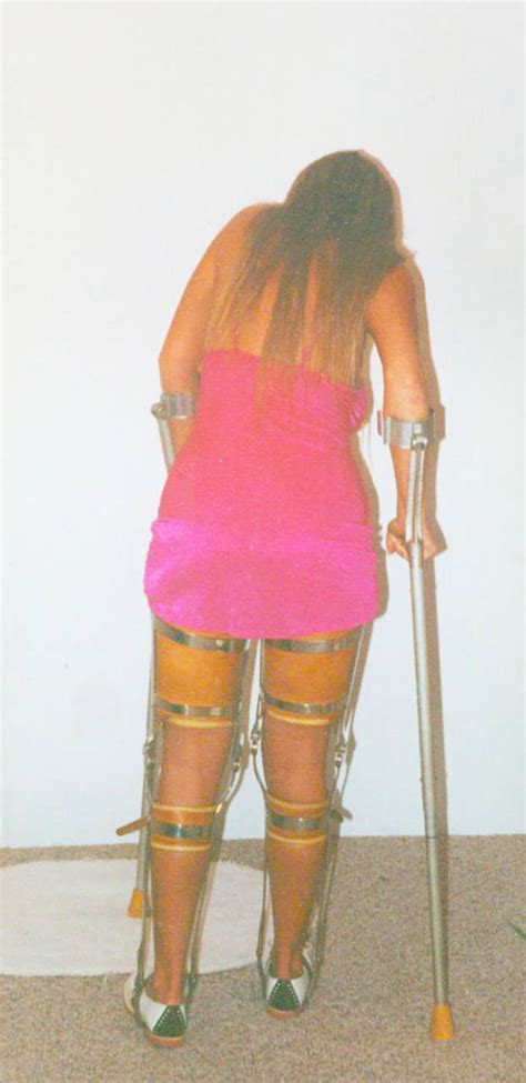 Ex Dancer Sexy In Leg Braces By Legphotog On Deviantart